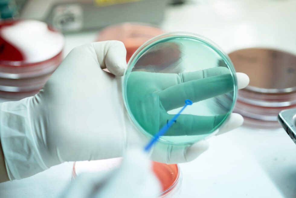 Women's Health PCR Pathogen Panel - GoldenPoint Scientific Labs